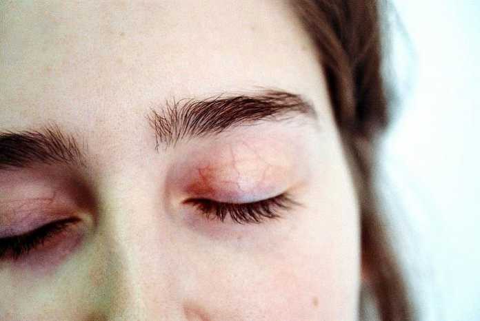 How to Detect a Psychosomatic Disorder? | Geniusbeauty